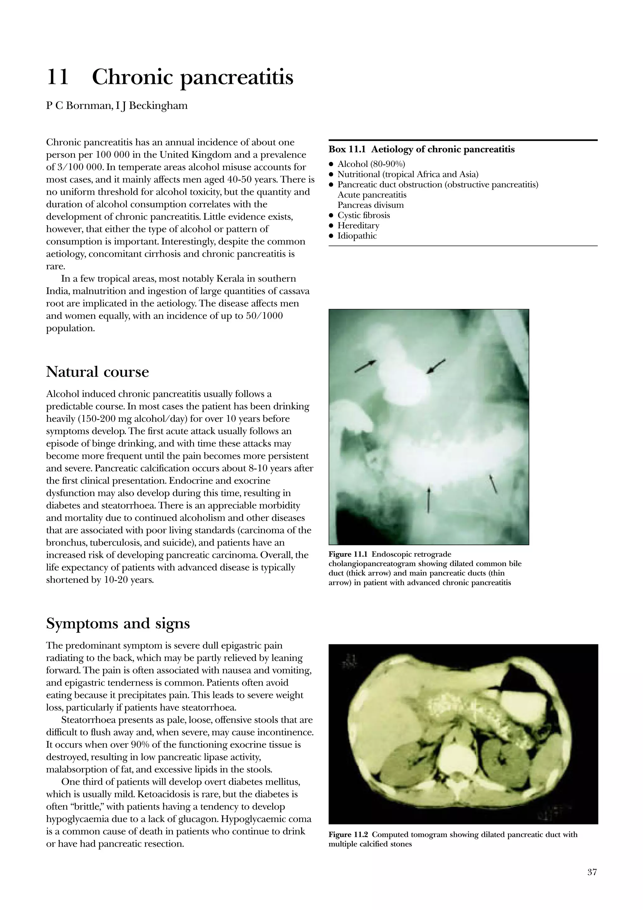 Abc of liver pancreas and gall bladder 2001 | PDF