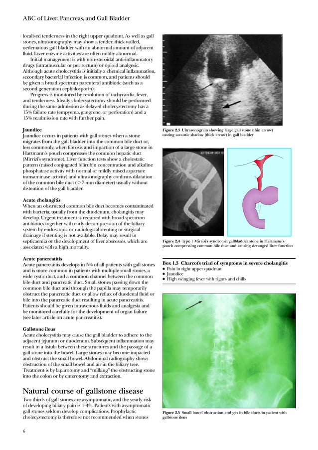 Abc of liver pancreas and gall bladder 2001 | PDF