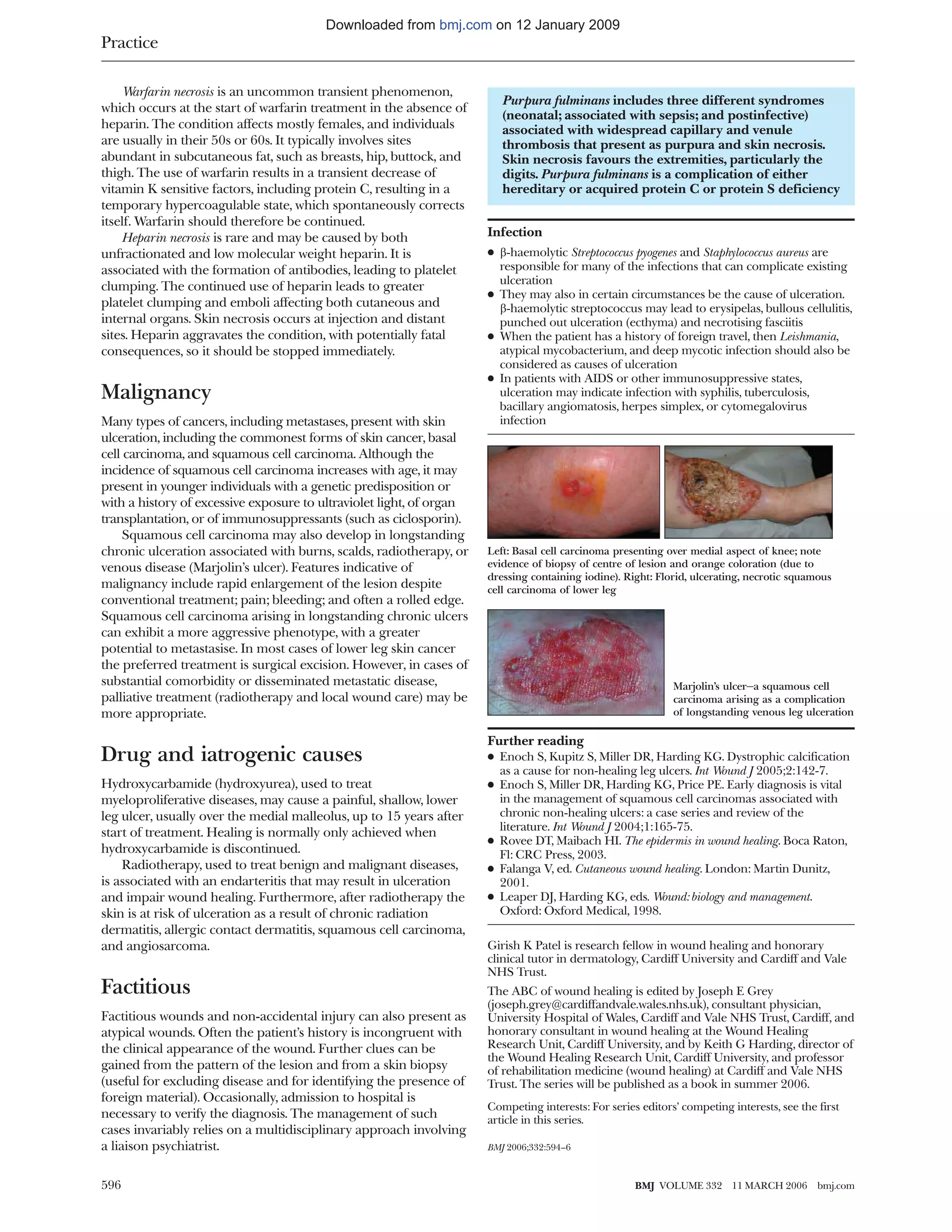 Abc of wound healing 2009 | PDF