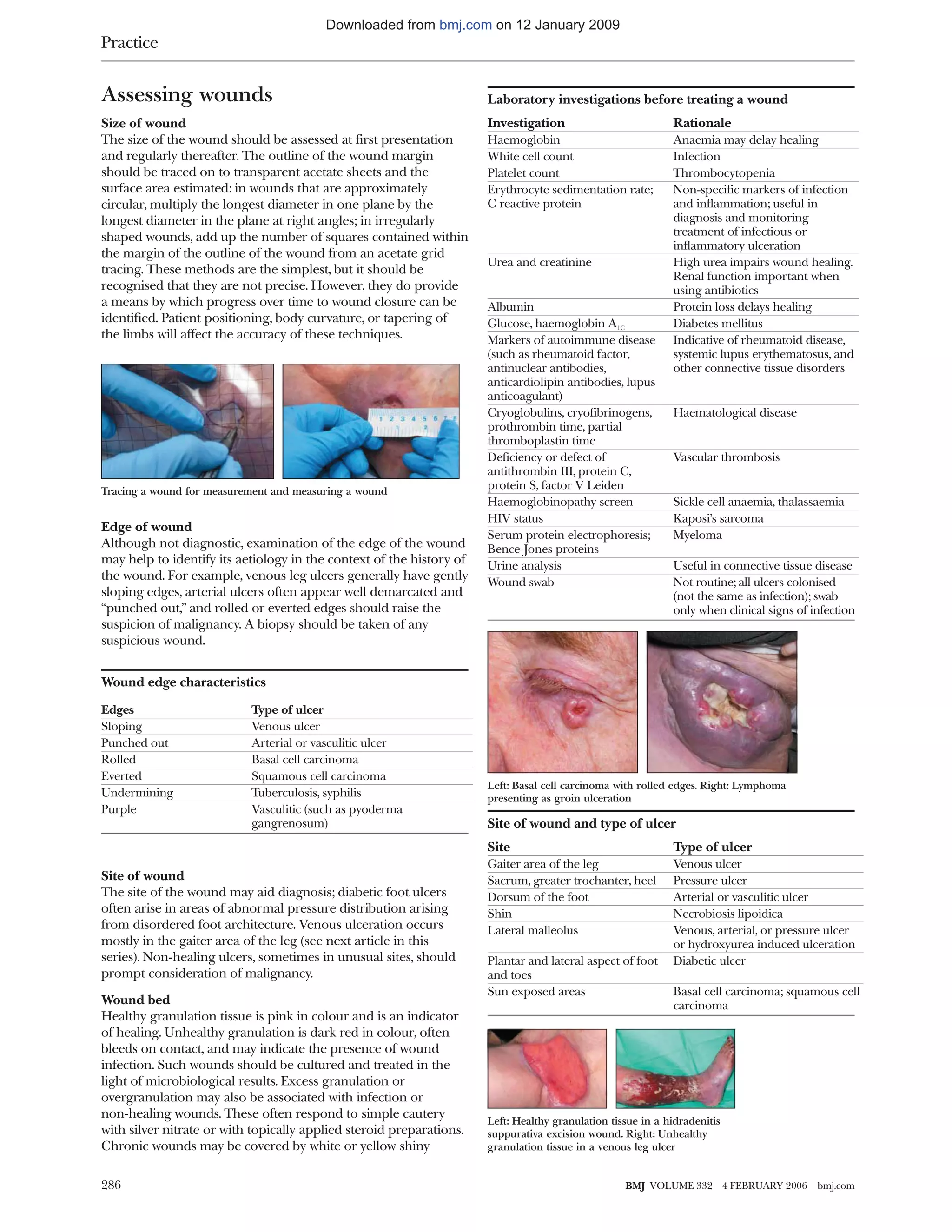 Abc of wound healing 2009 | PDF