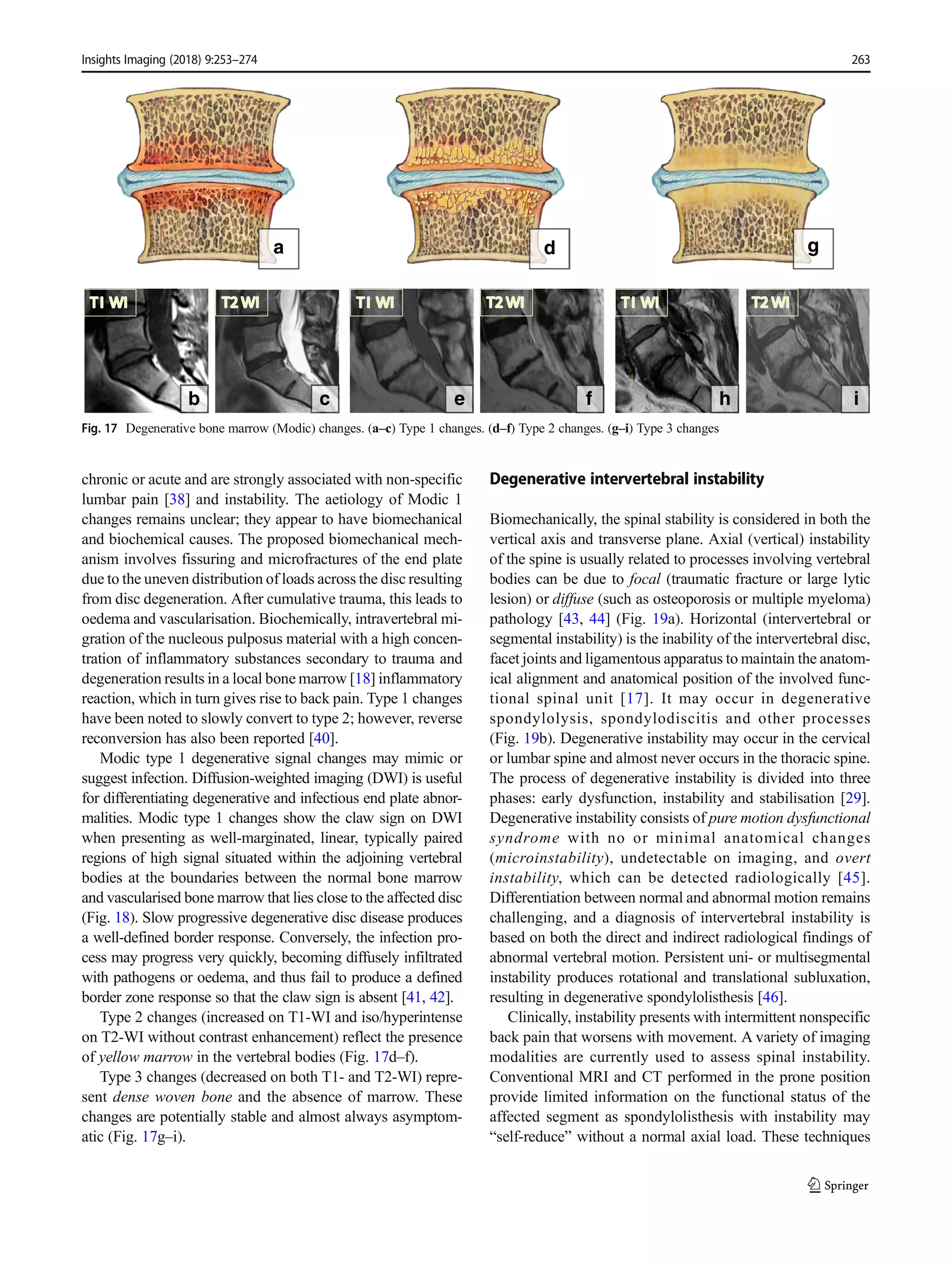Abcs of the degenerative spine | PDF