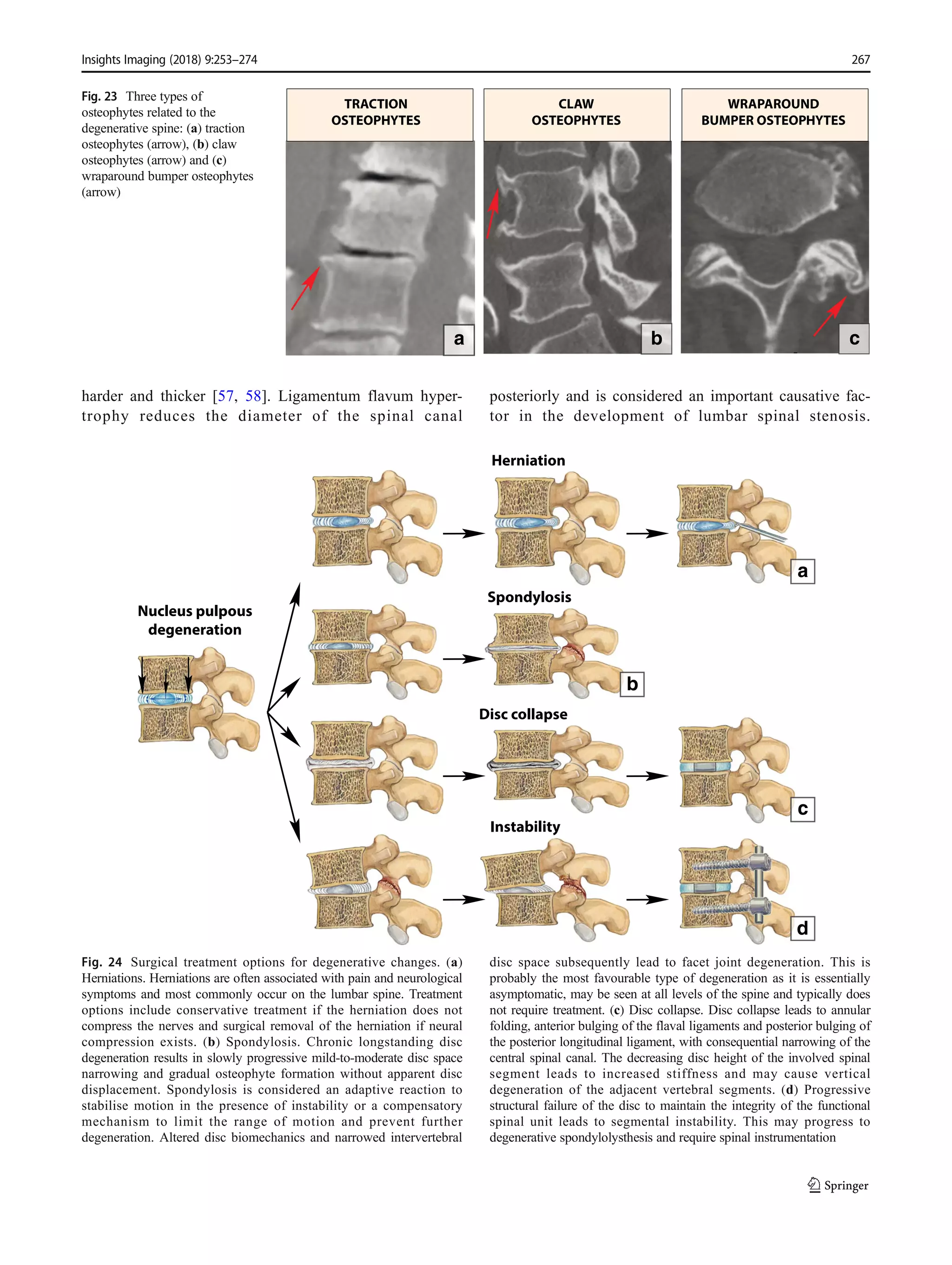 Abcs of the degenerative spine | PDF