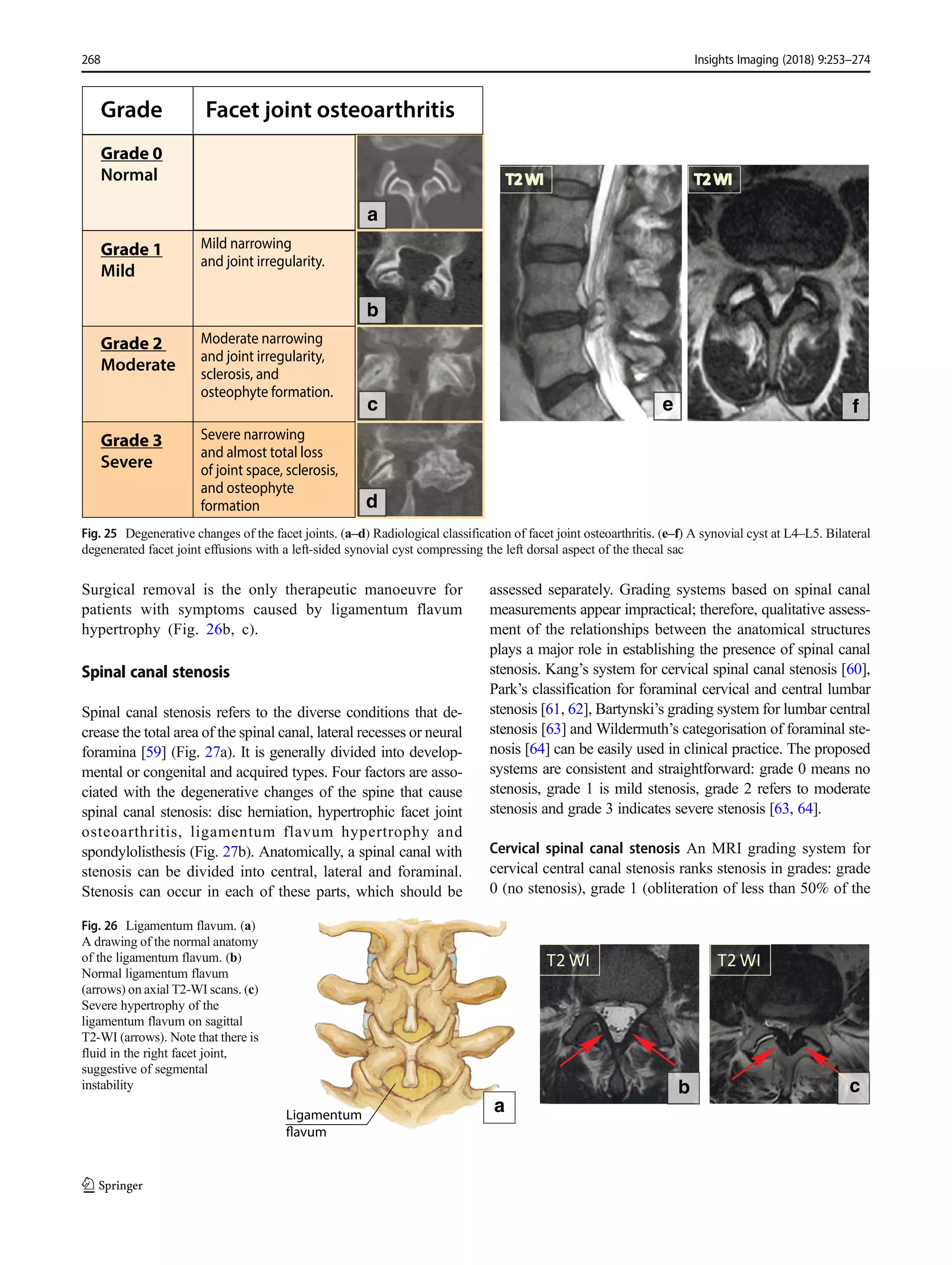 Abcs of the degenerative spine | PDF