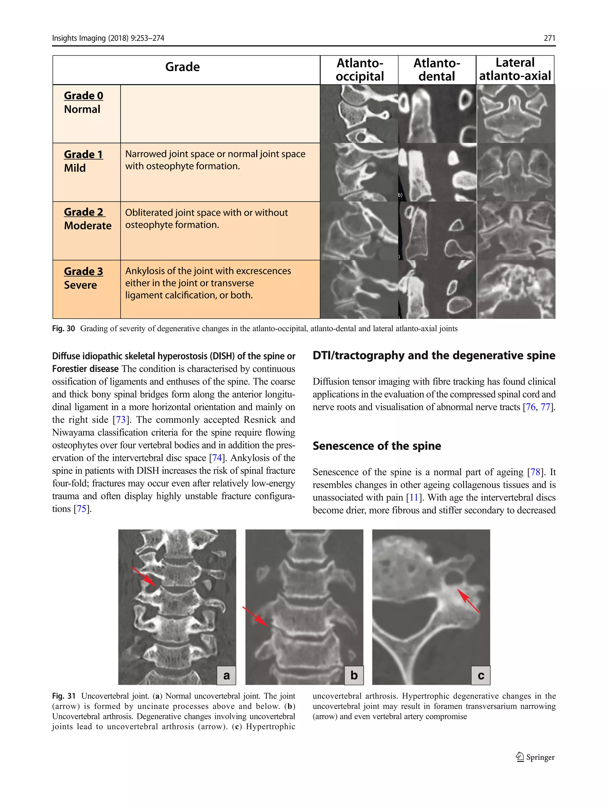 Abcs of the degenerative spine | PDF
