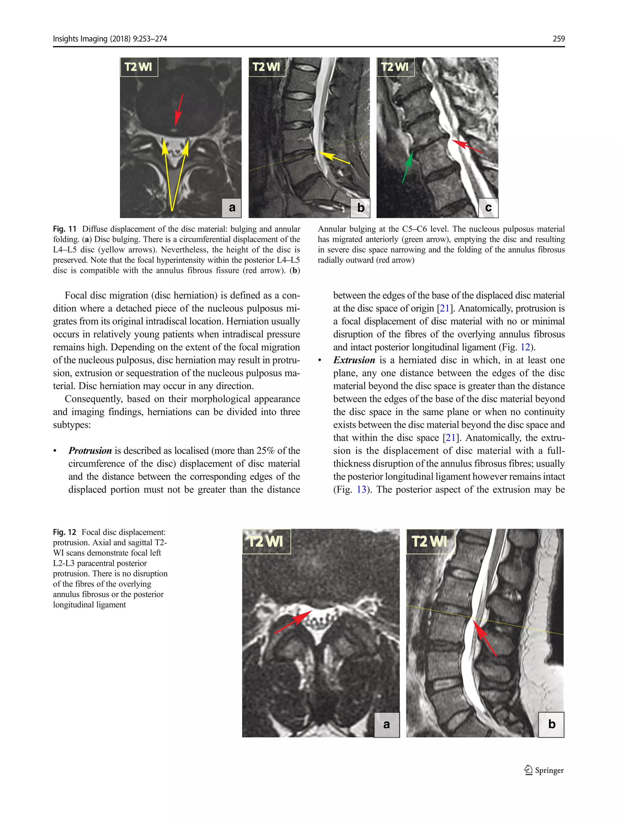 Abcs of the degenerative spine | PDF