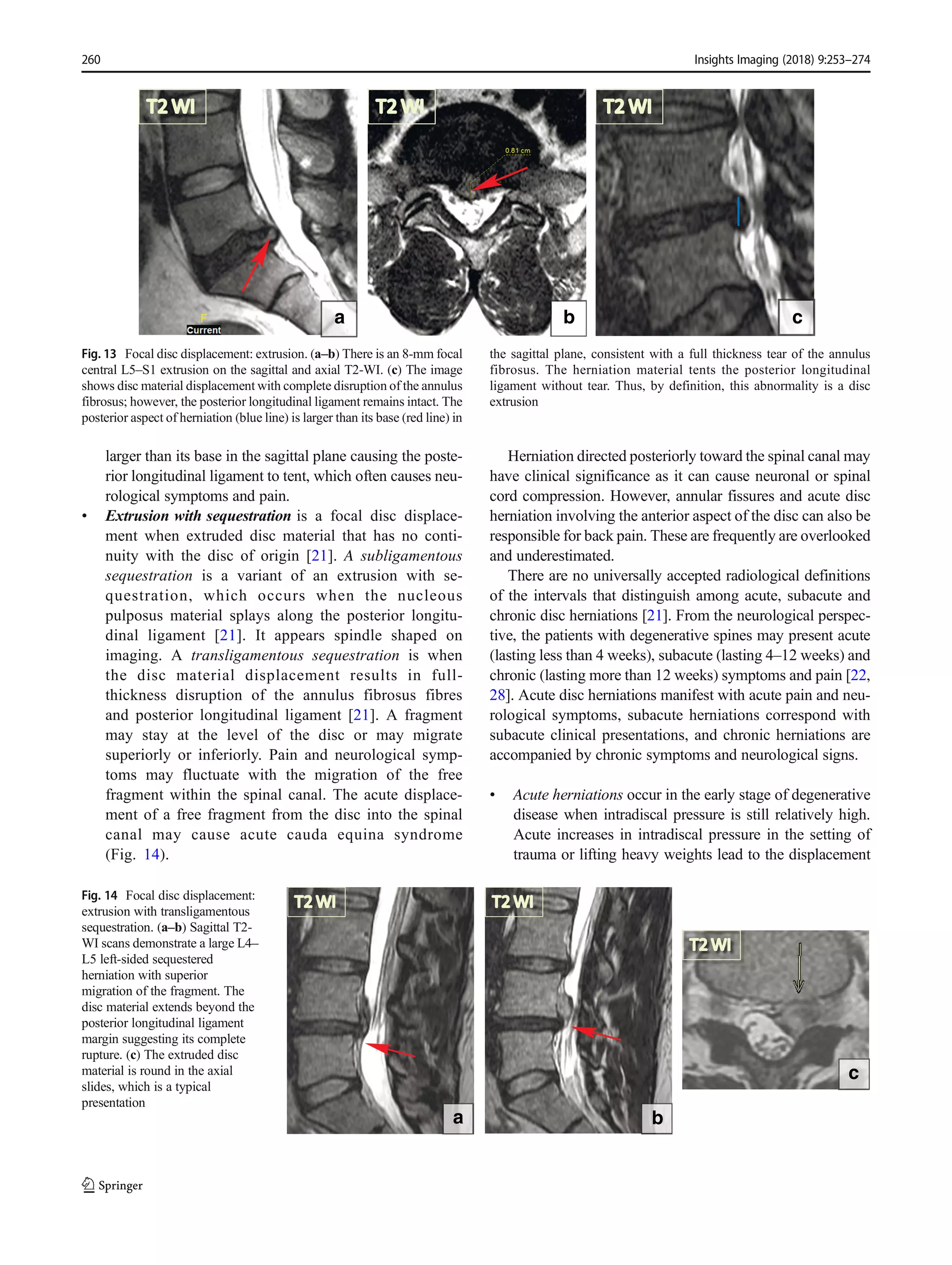 Abcs of the degenerative spine | PDF