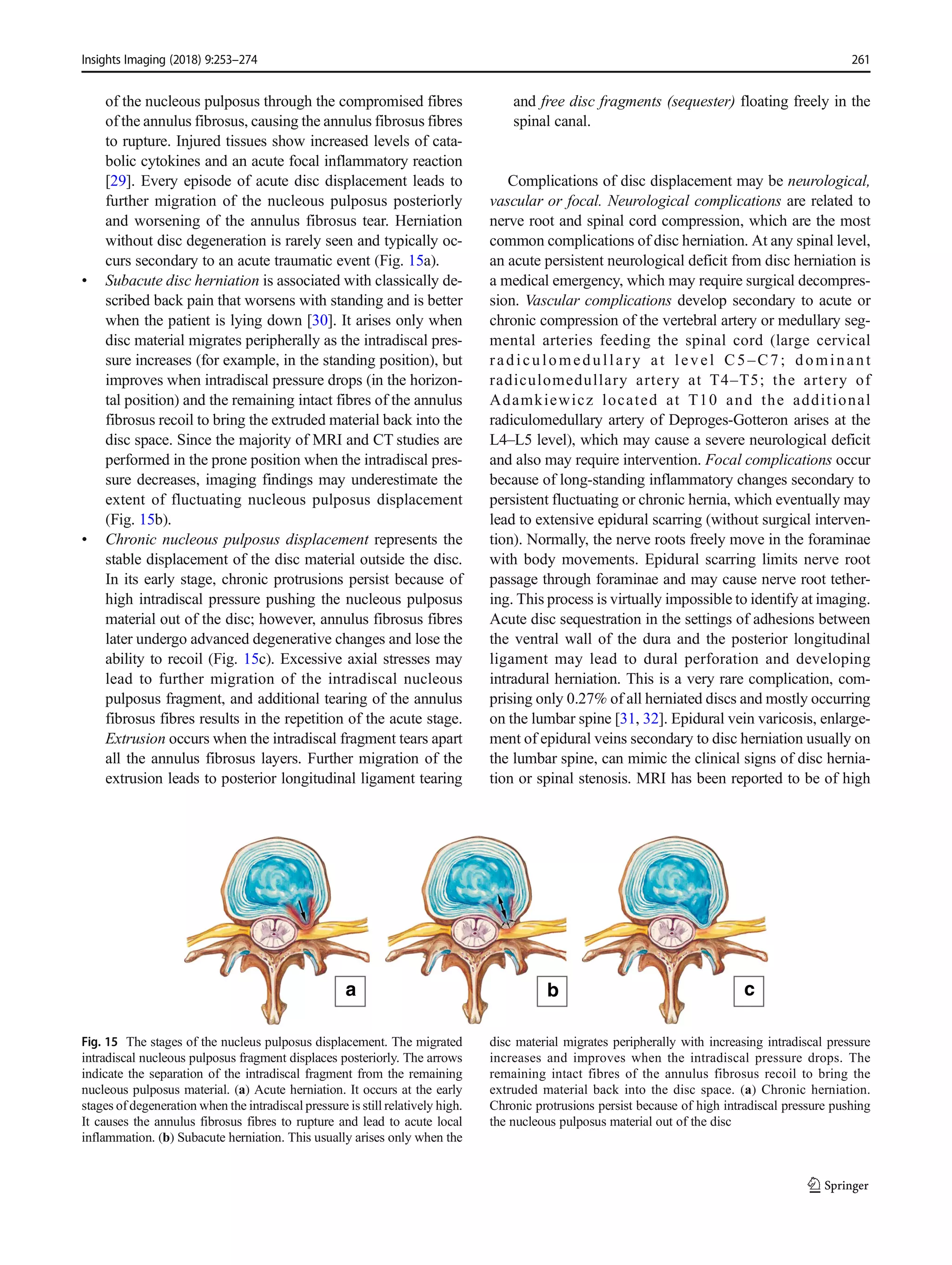 Abcs of the degenerative spine | PDF