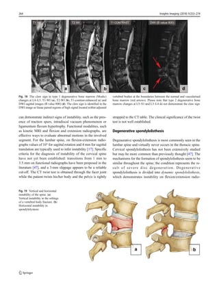 Abcs of the degenerative spine | PDF