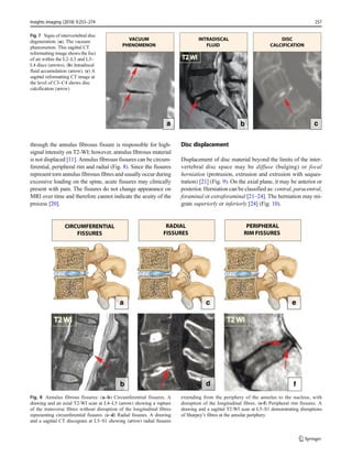 Abcs of the degenerative spine | PDF