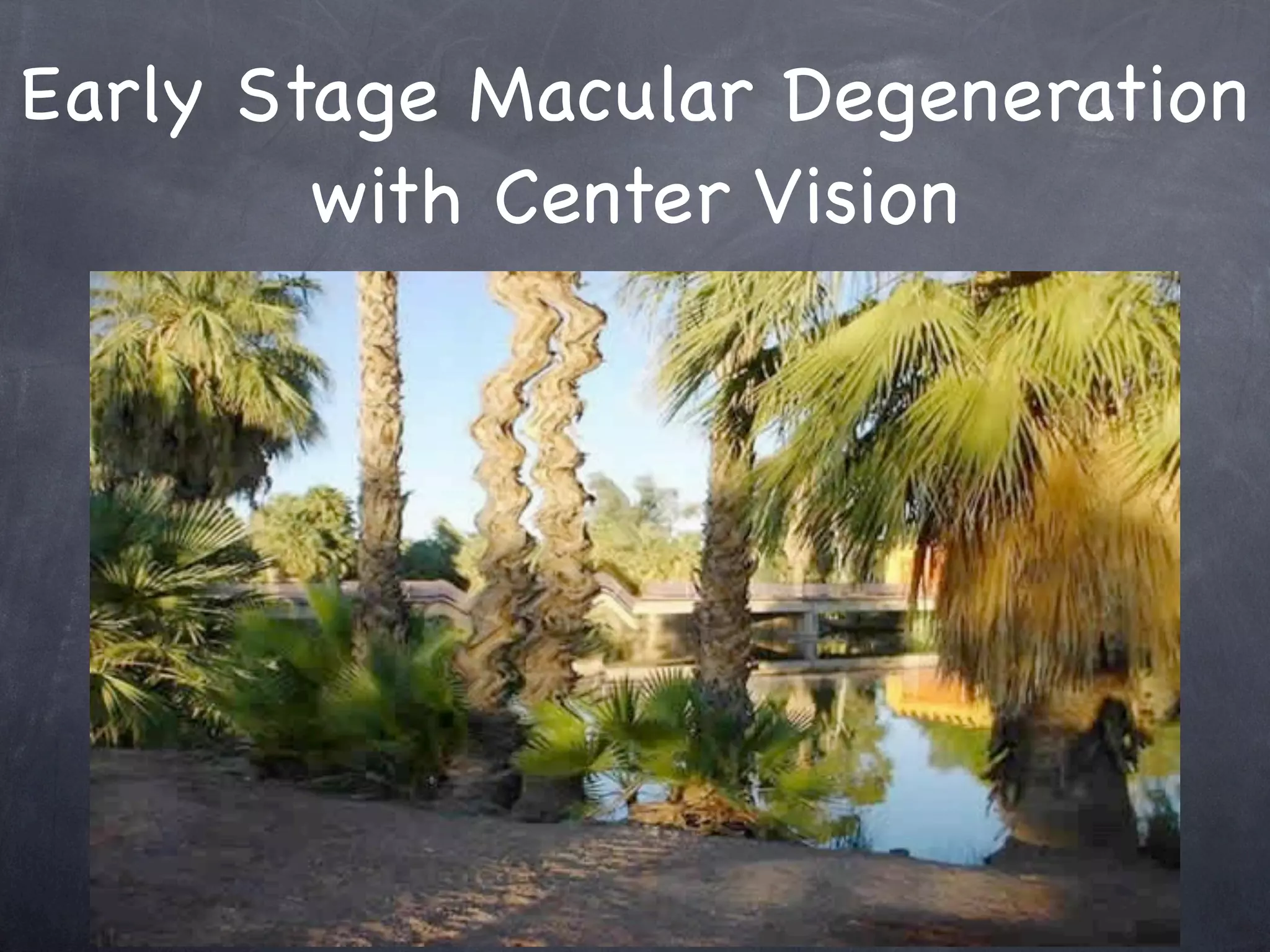 Abc's of vision impairments and communication styles | PPT