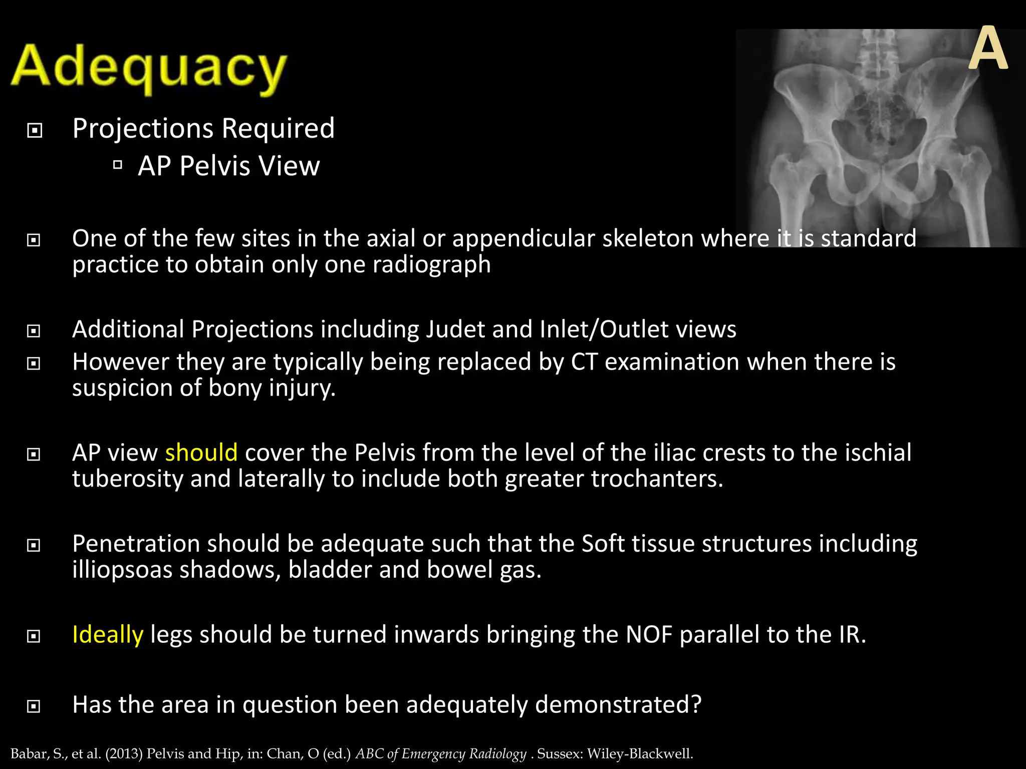 Trauma Image Interpretation of the Pelvis and Hip Radiographs: Using ...