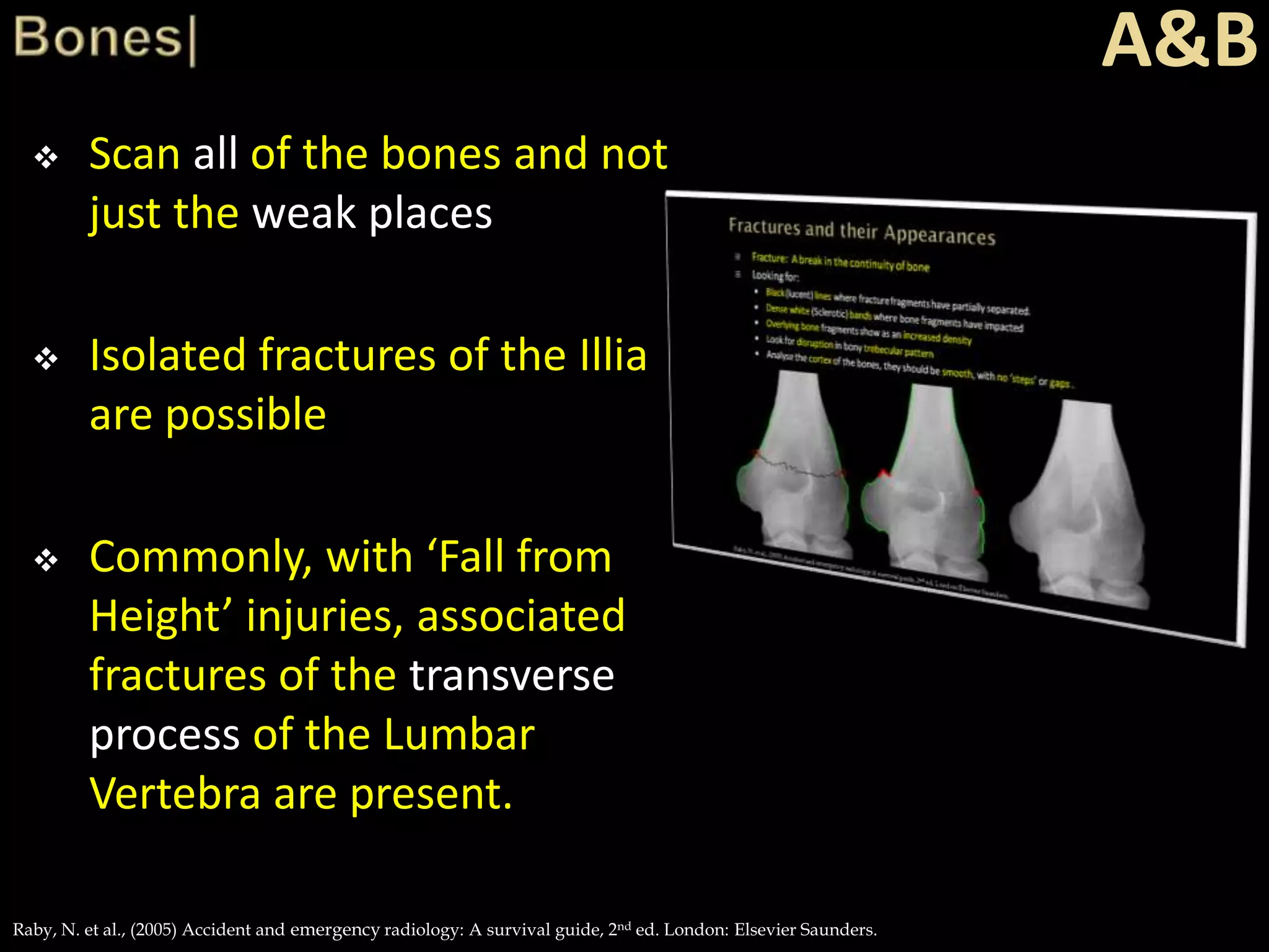 Trauma Image Interpretation of the Pelvis and Hip Radiographs: Using ...