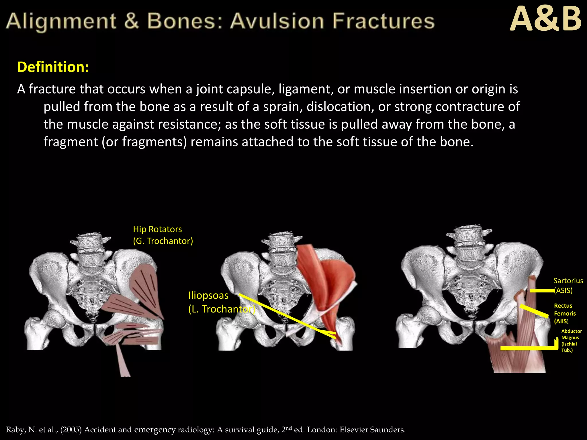 Trauma Image Interpretation of the Pelvis and Hip Radiographs: Using ...
