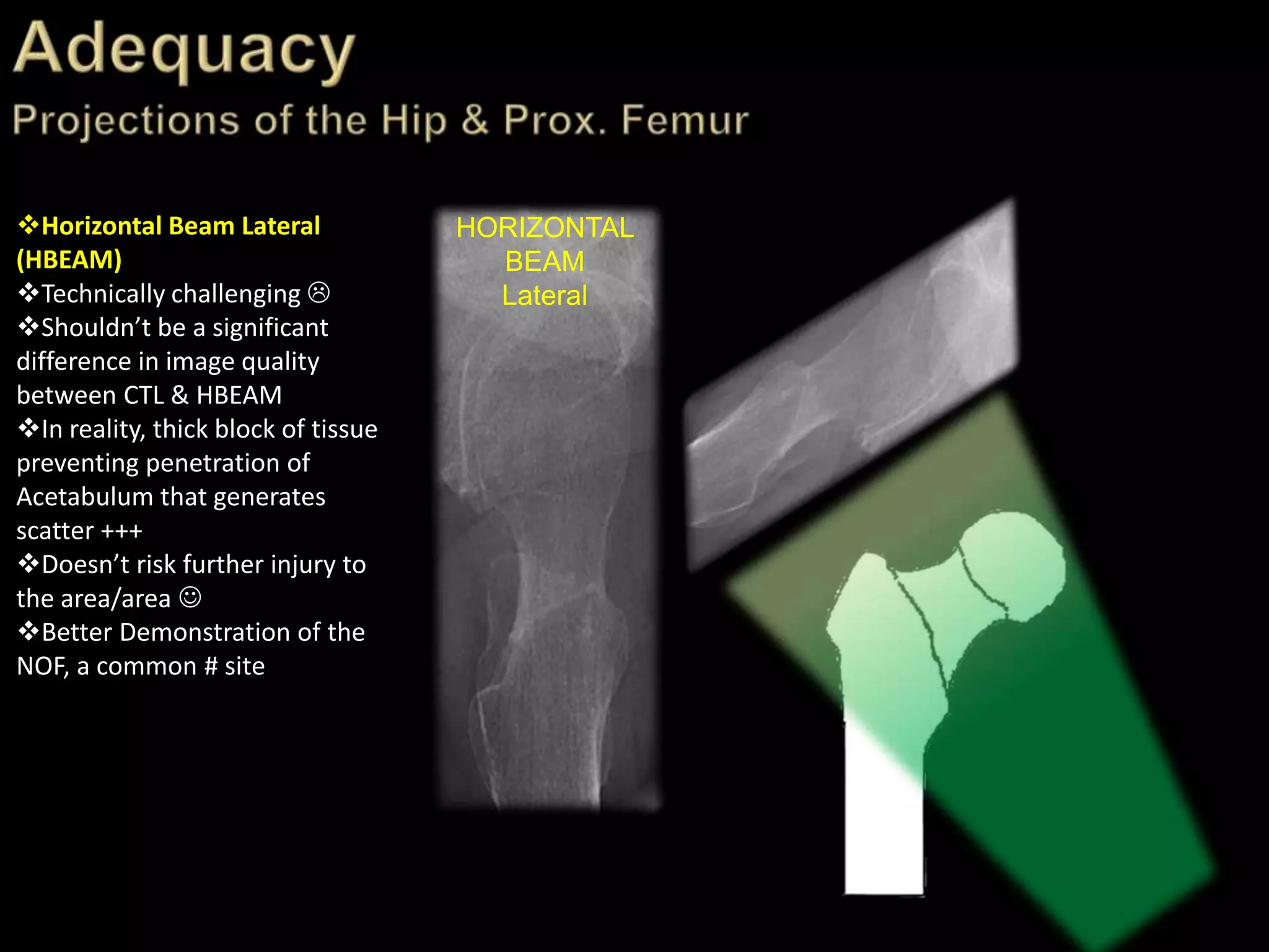 Trauma Image Interpretation of the Pelvis and Hip Radiographs: Using ...
