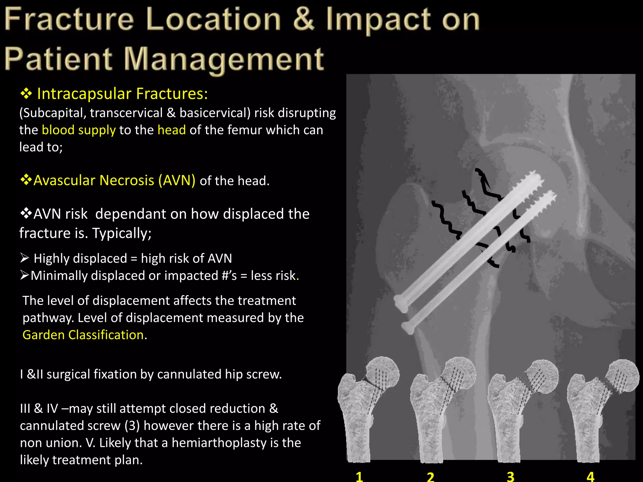 Trauma Image Interpretation of the Pelvis and Hip Radiographs: Using ...