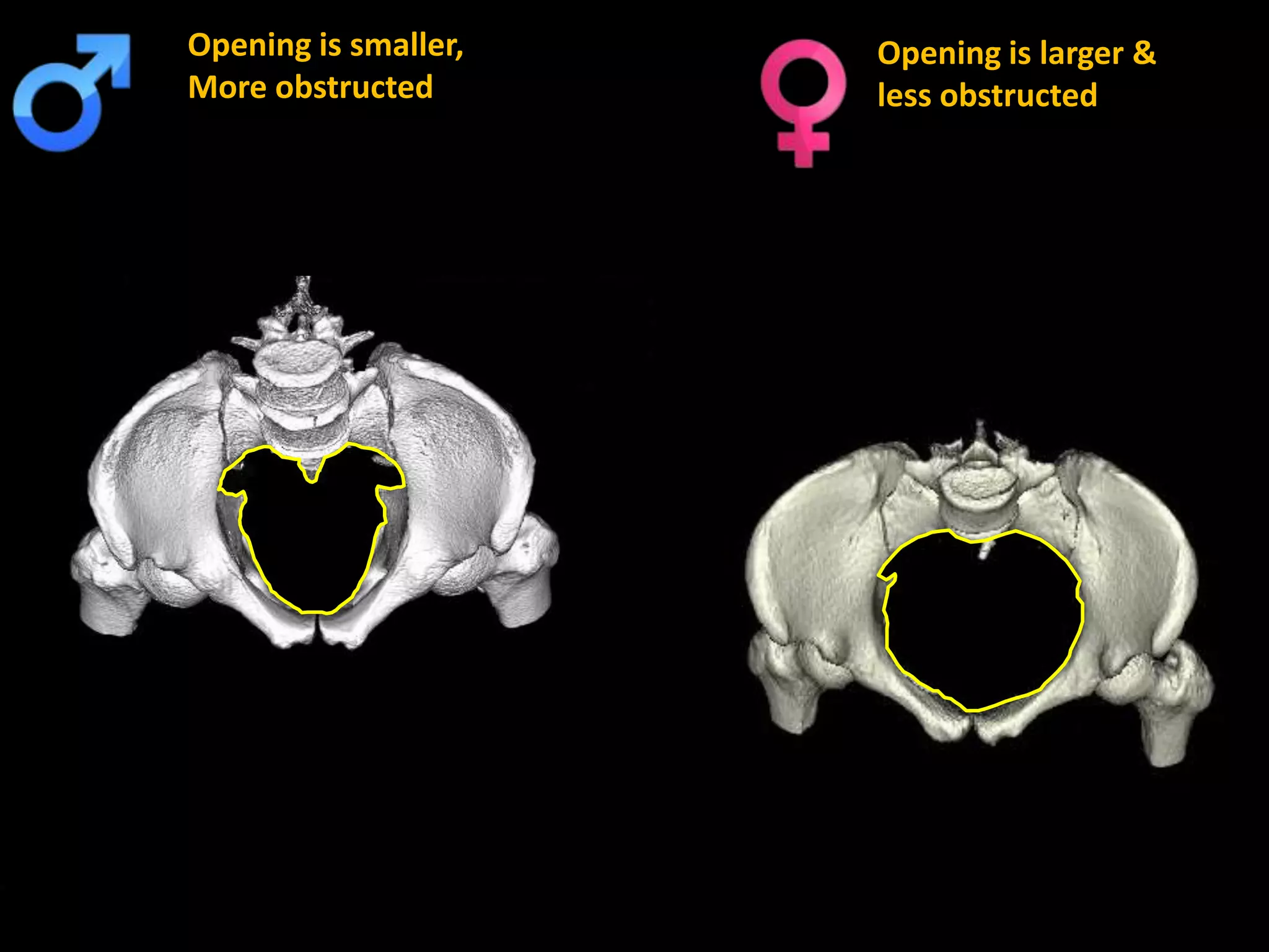 Trauma Image Interpretation of the Pelvis and Hip Radiographs: Using ...
