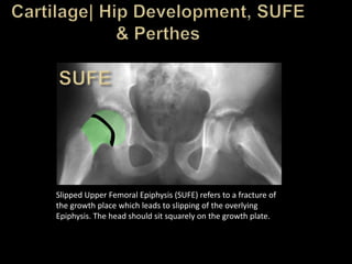 Trauma Image Interpretation of the Pelvis and Hip Radiographs: Using ...