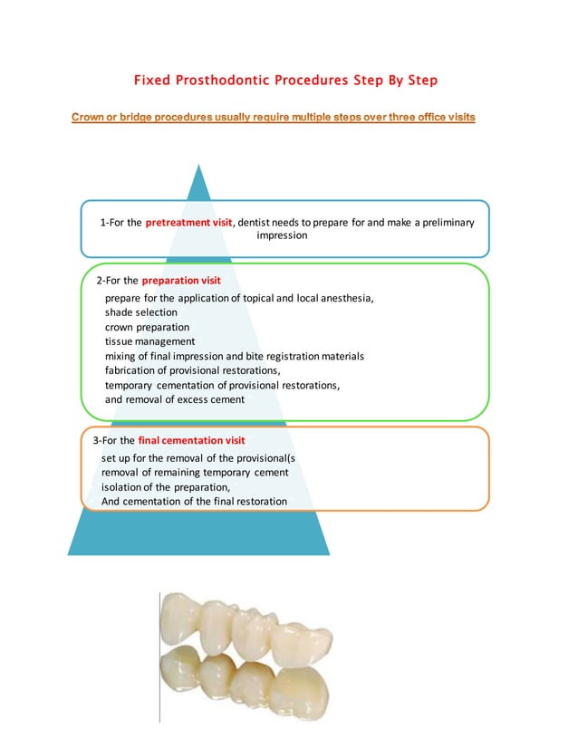 Steps For fixed Provisionals | DOCX | Oral care | Personal Care