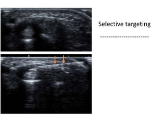 Case presentation ESRD 40th | PPT