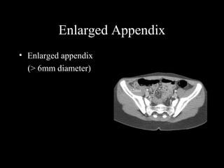 Abd ct appendicitis | PPT | Digestive Disorders | Diseases and Conditions