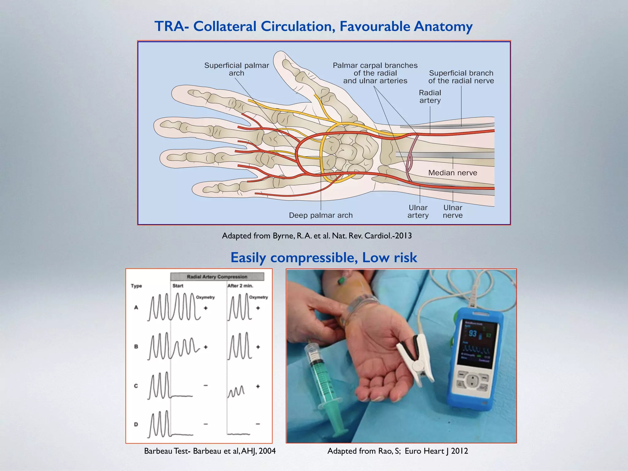 Abdelaal E - AIMRADIAL 2014 Technical - Local complications | PDF