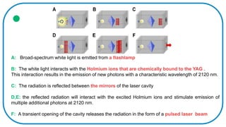 Holmium YAG vs thulium fiber laser .pptx