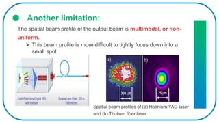 Holmium YAG vs thulium fiber laser .pptx