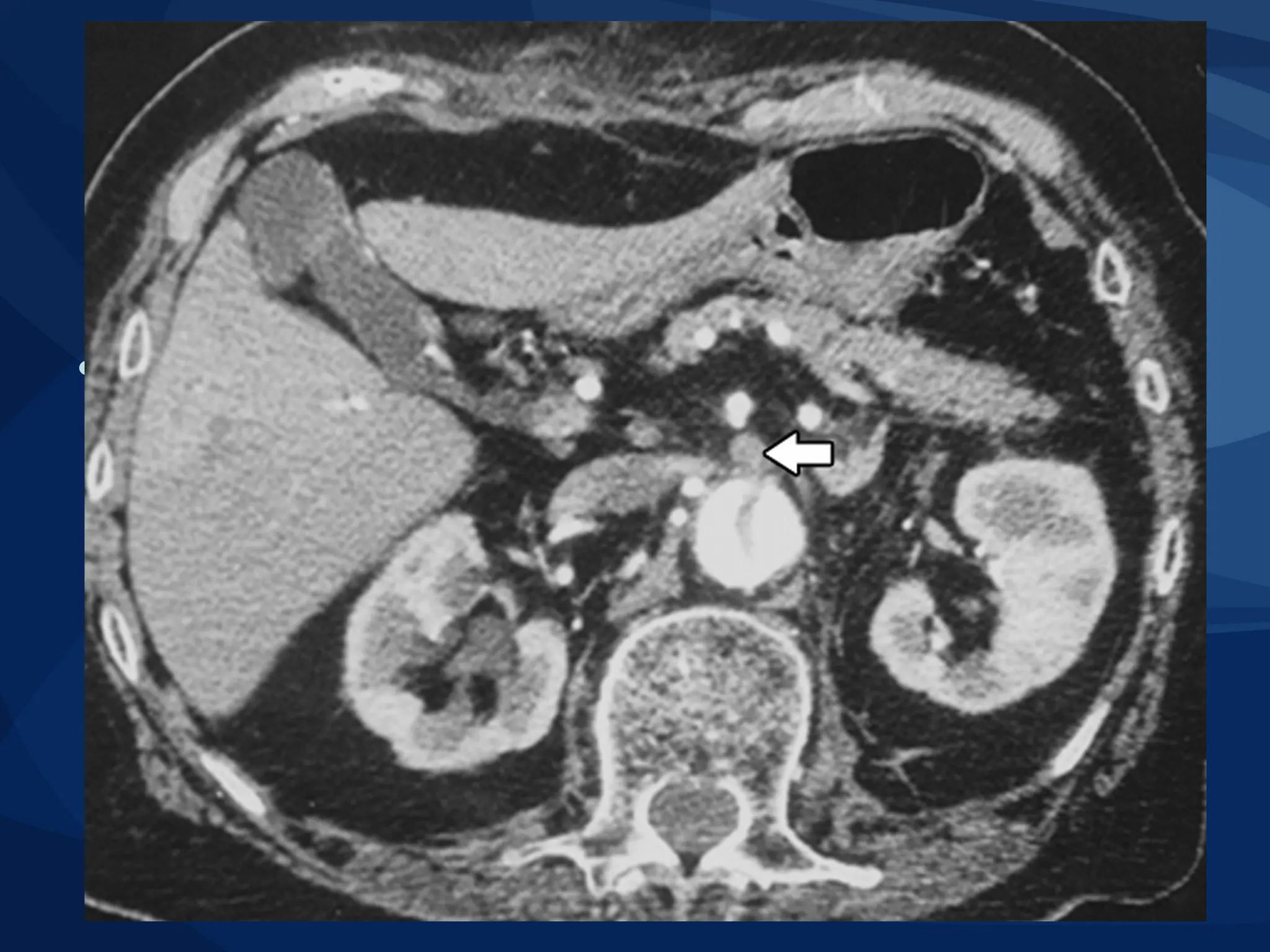 Overview of abdominal emergencies in the ED.ppt | Digestive Disorders ...