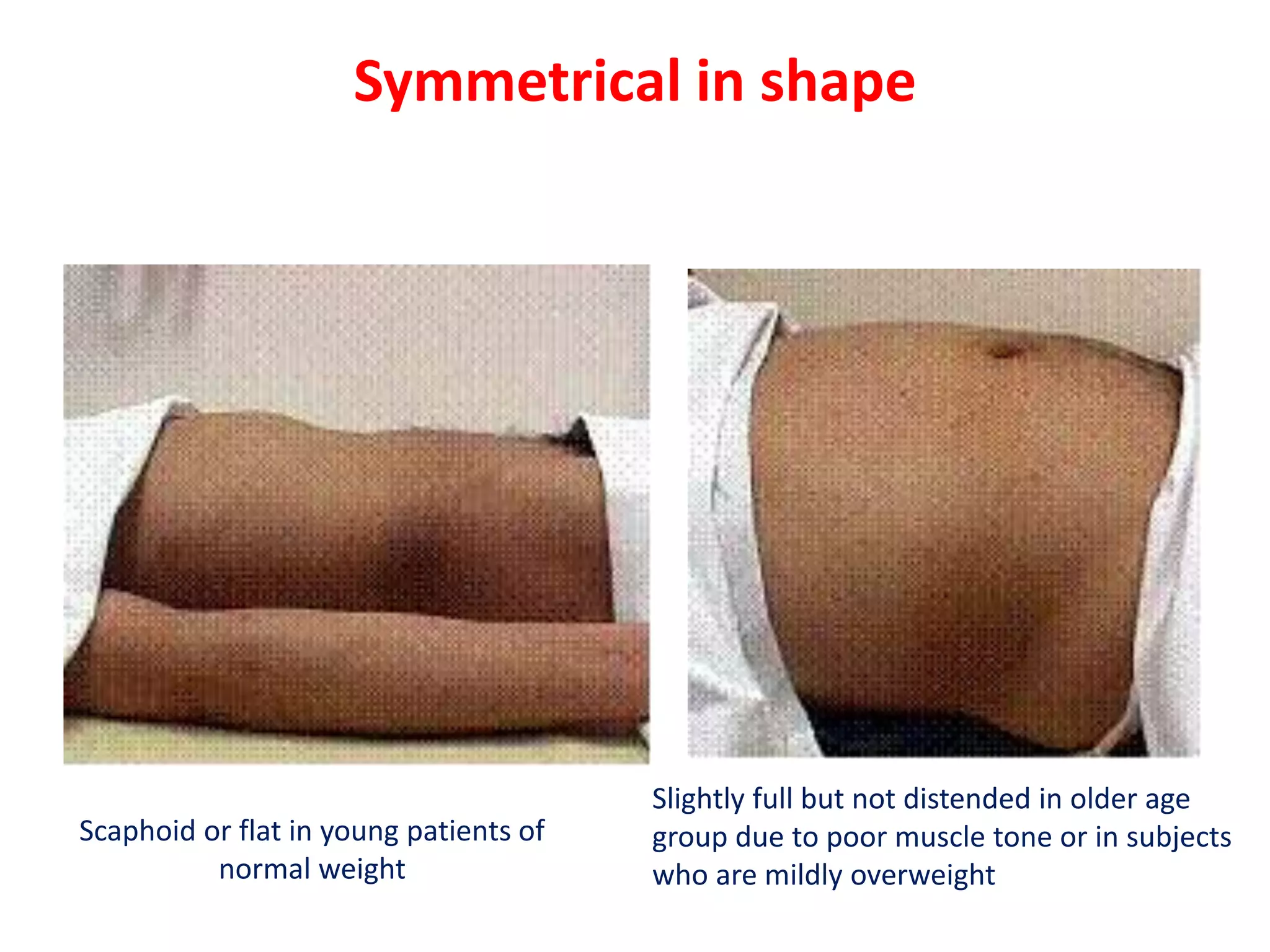 Abdoiminal examination | PPTX