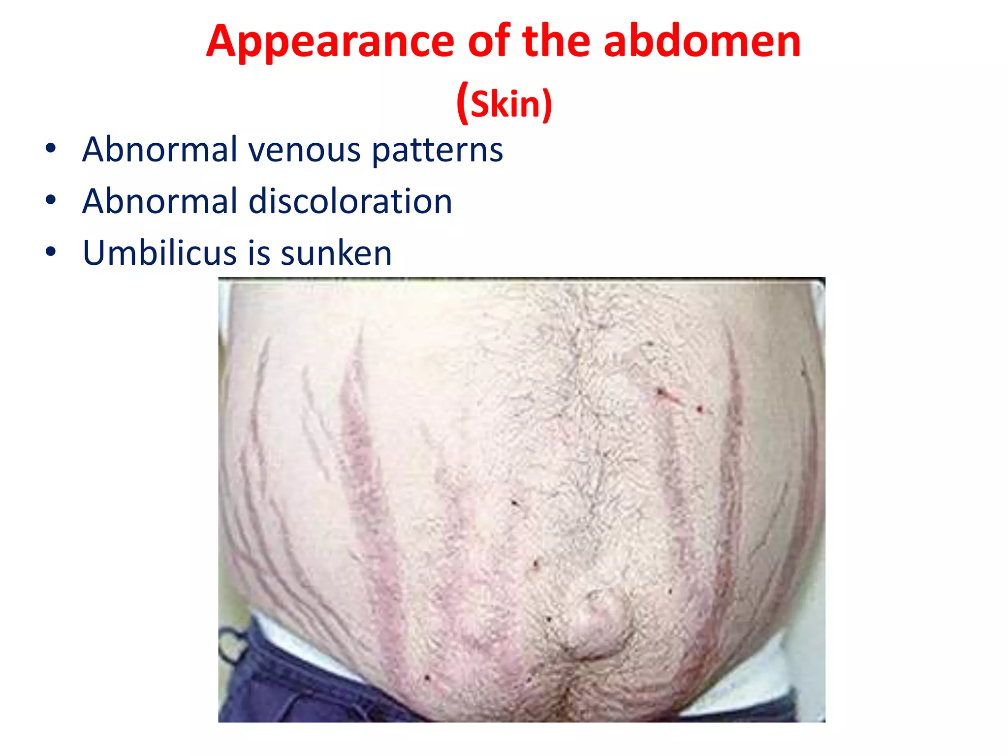 Abdoiminal examination | PPTX