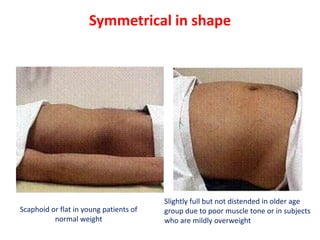 Scaphoid Shaped Abdomen