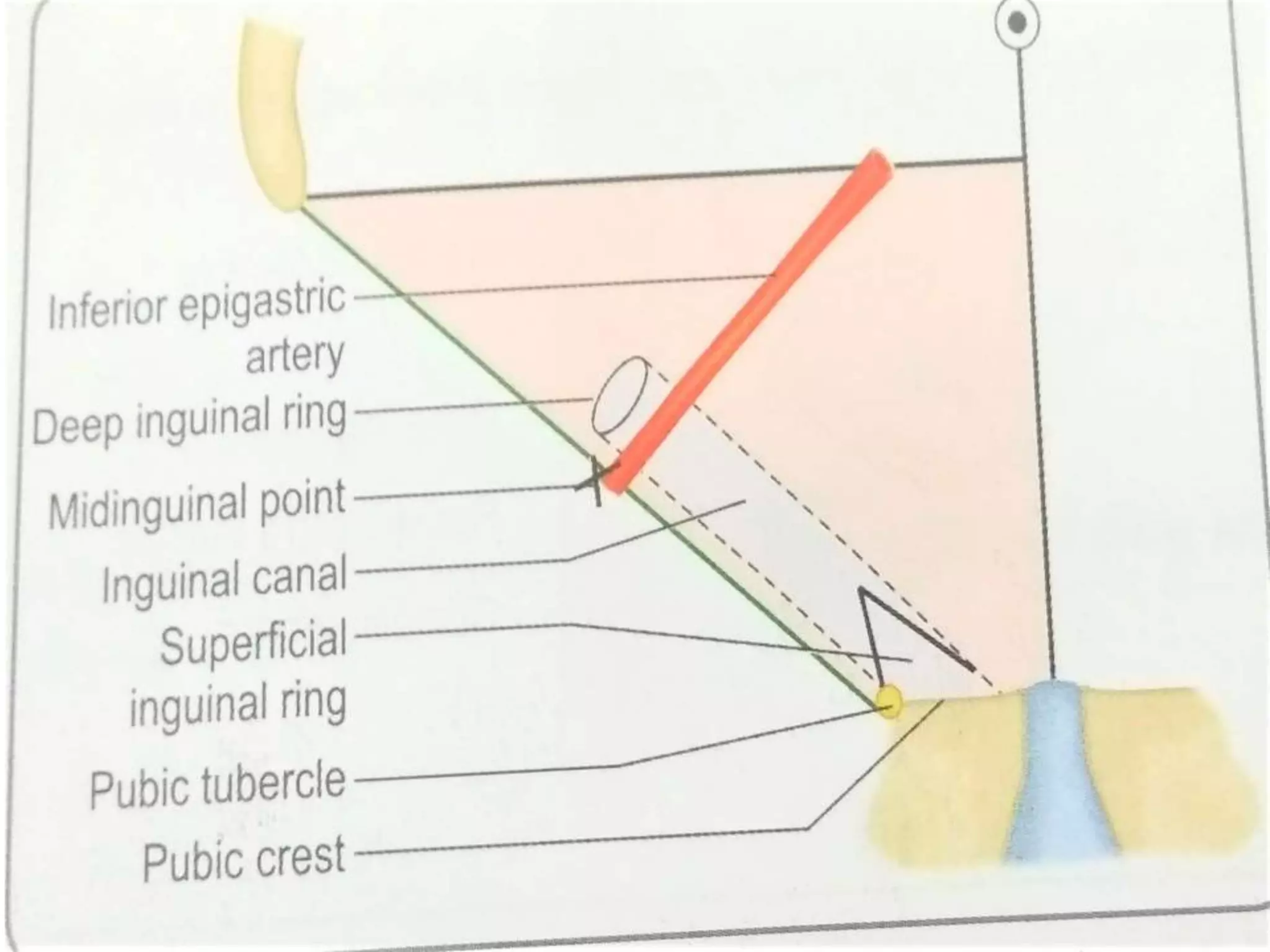 Abdoman ppt 2 (Inguinal region).pptx