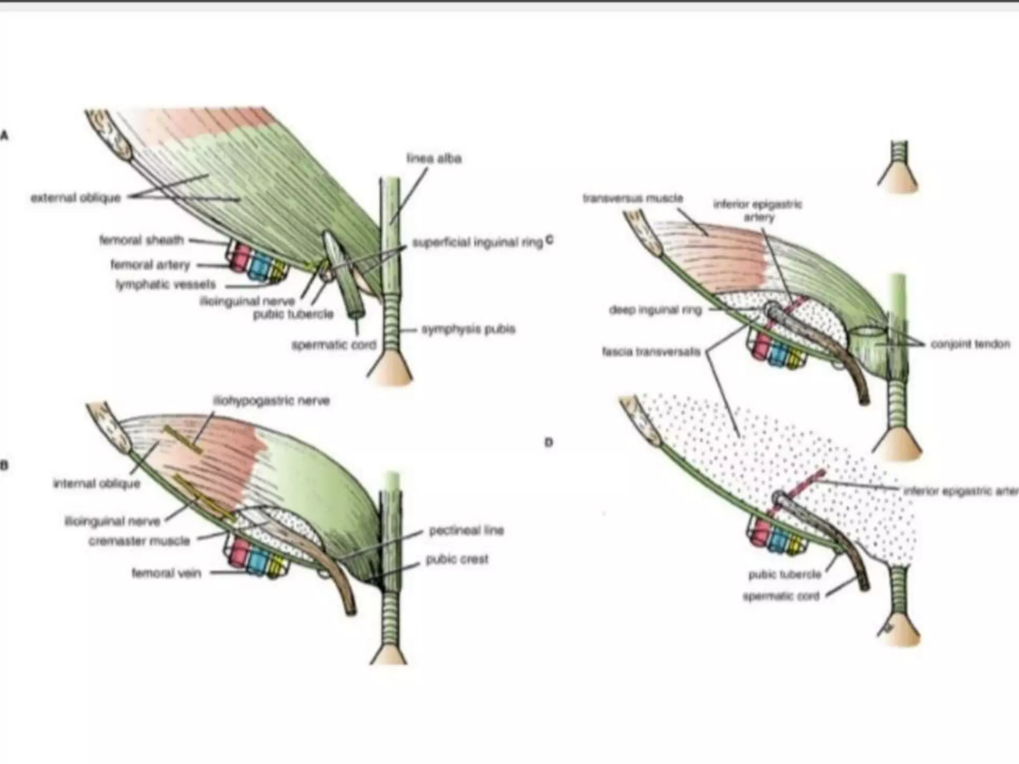 Abdoman ppt 2 (Inguinal region).pptx