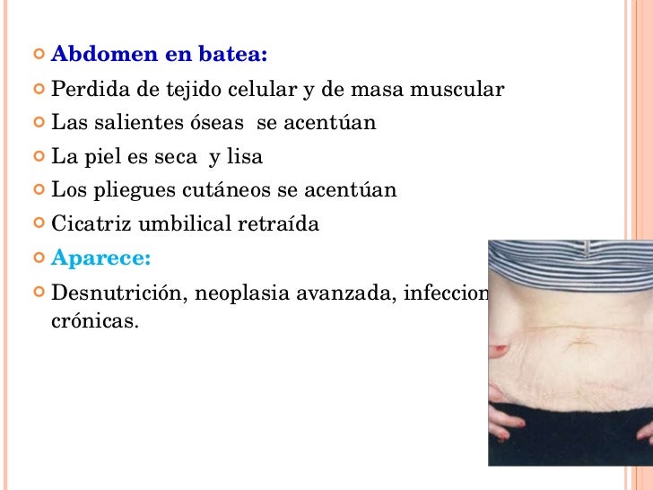 Abdomen
