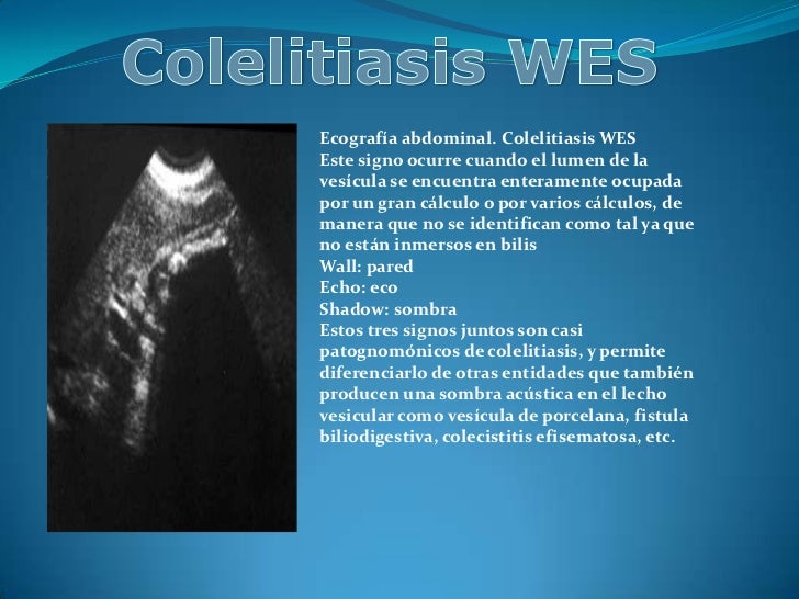 Abdomen