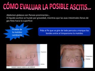 Semiología del Abdomen | PPTX