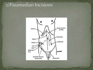 Abdomen layers & surgical incisions | PPTX | Death, Injury, or Military ...