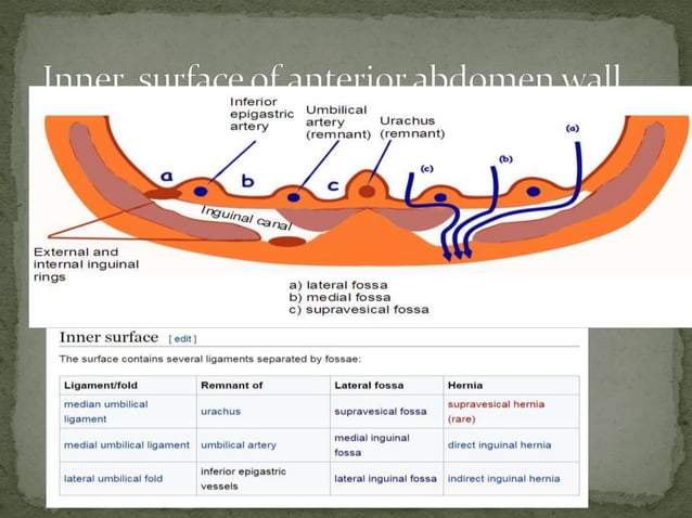 Abdomen layers & surgical incisions | PPTX | Death, Injury, or Military ...