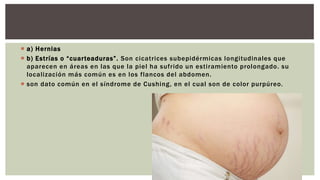 Abdomen | PPTX