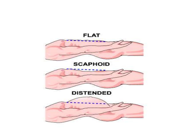Abdominal Inspection | PPT