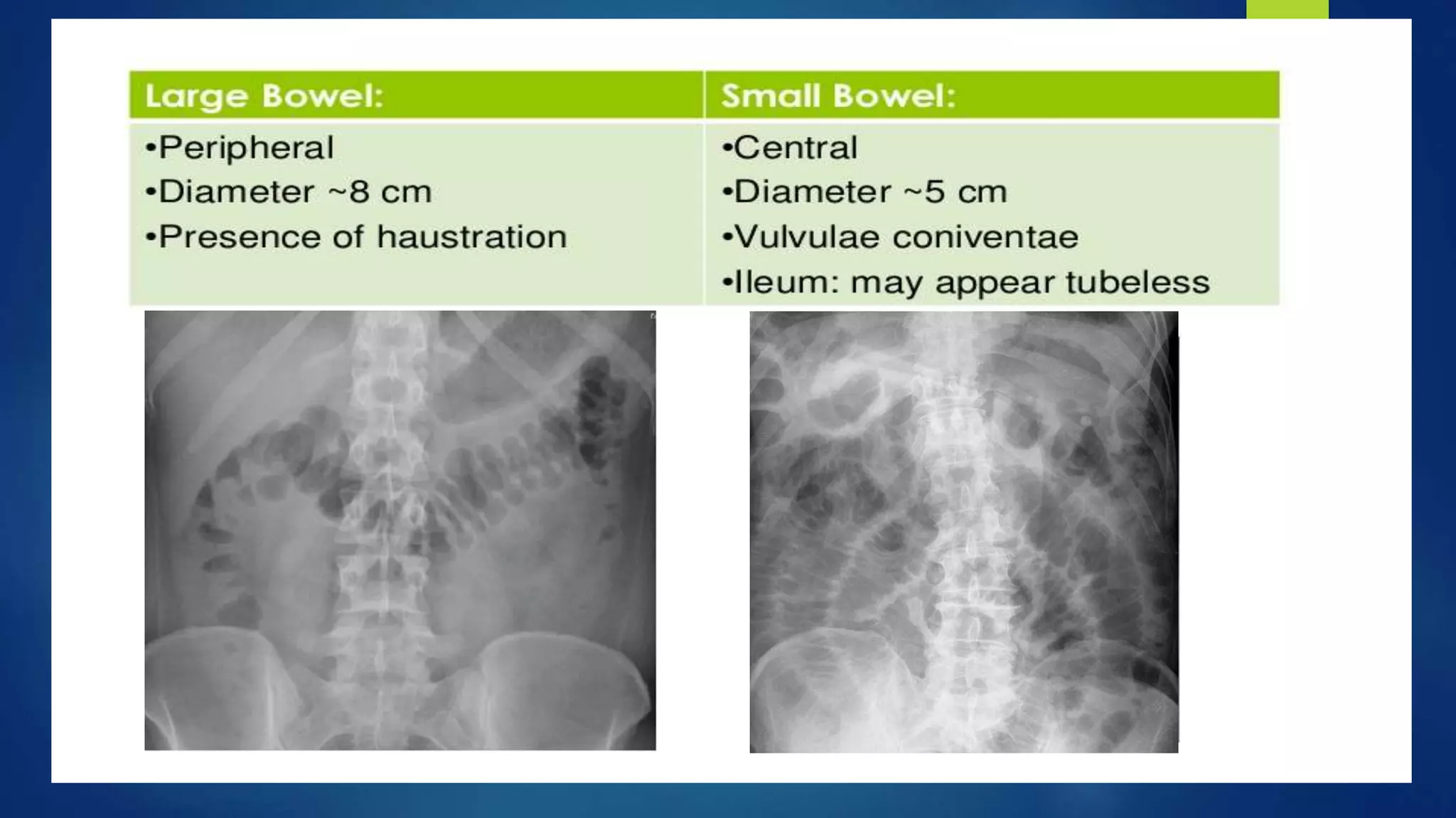 Abdomen imaging.pptx