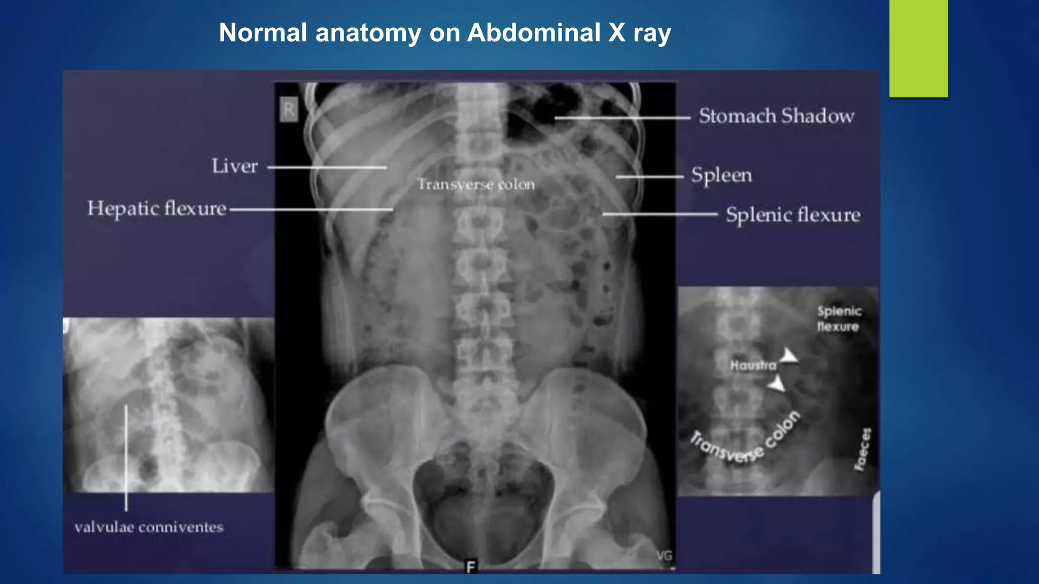 Abdomen imaging.pptx