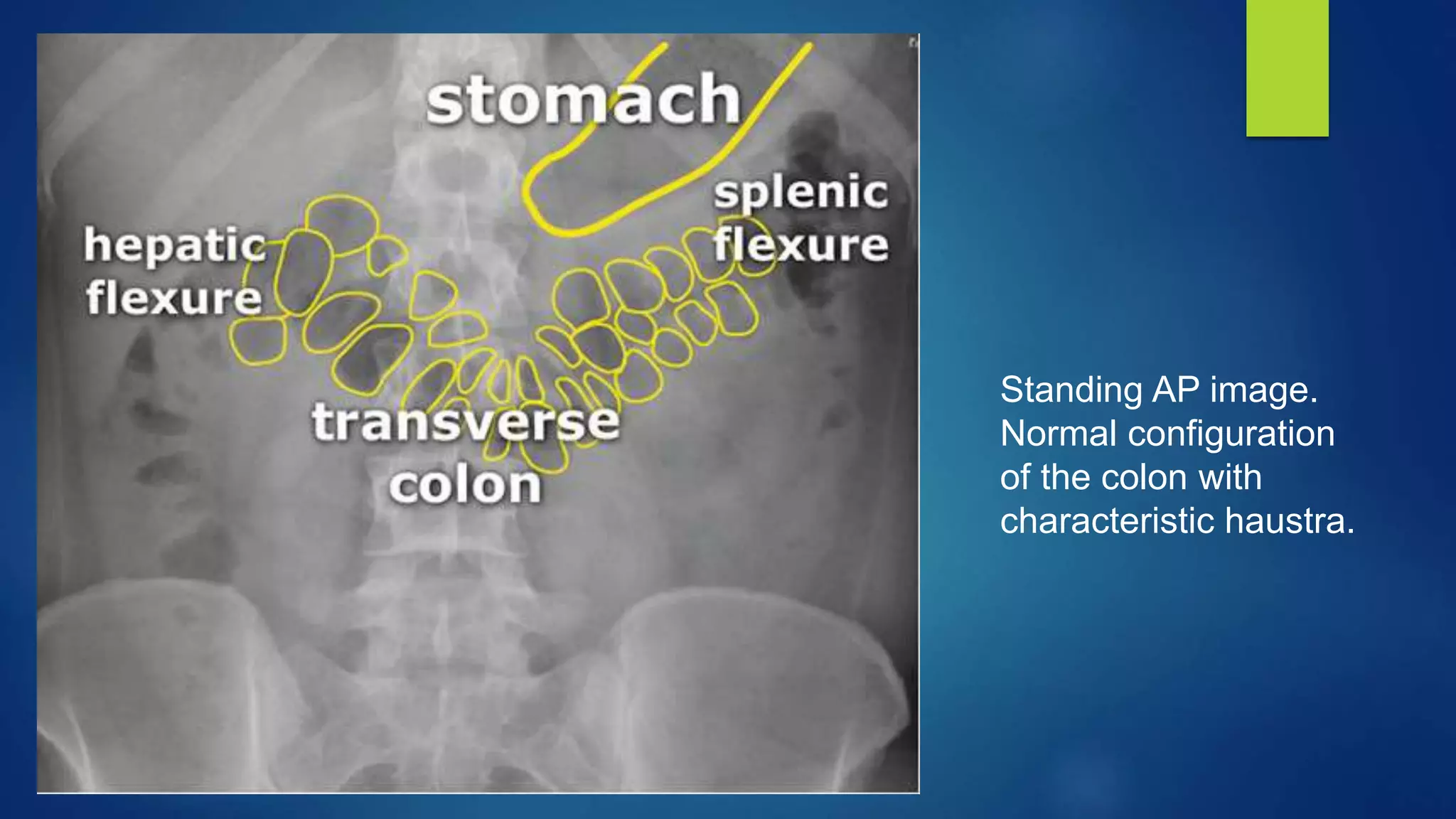 Abdomen imaging.pptx