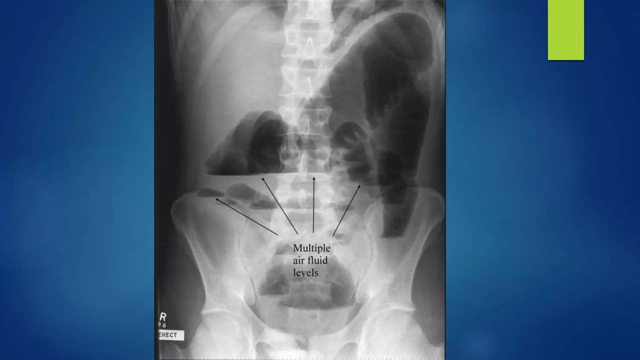 Abdomen imaging.pptx
