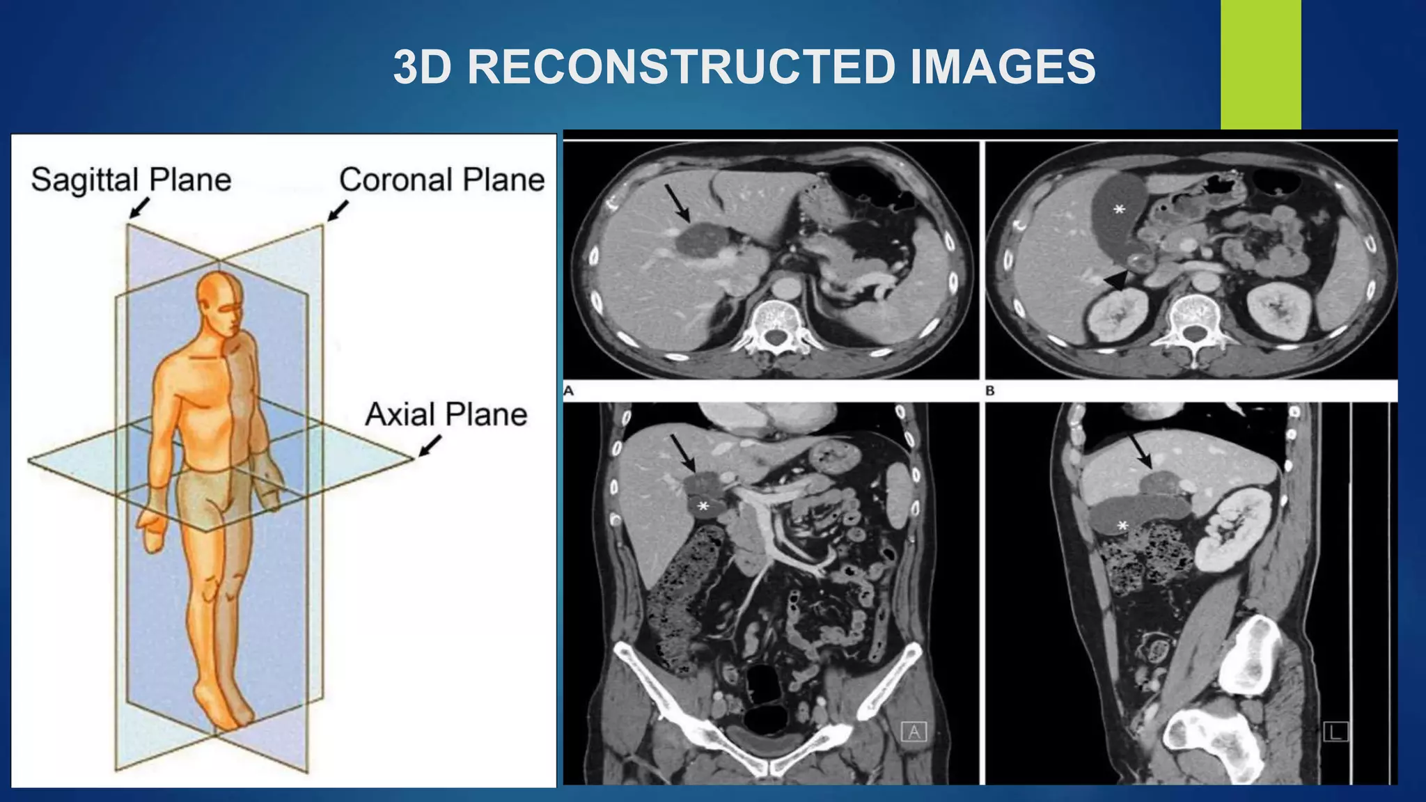 Abdomen imaging.pptx