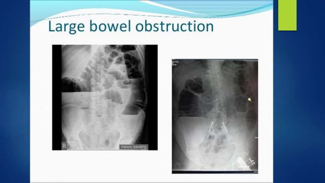 Abdomen imaging.pptx