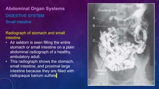 ABDOMEN.pptx | Digestive Disorders | Diseases and Conditions