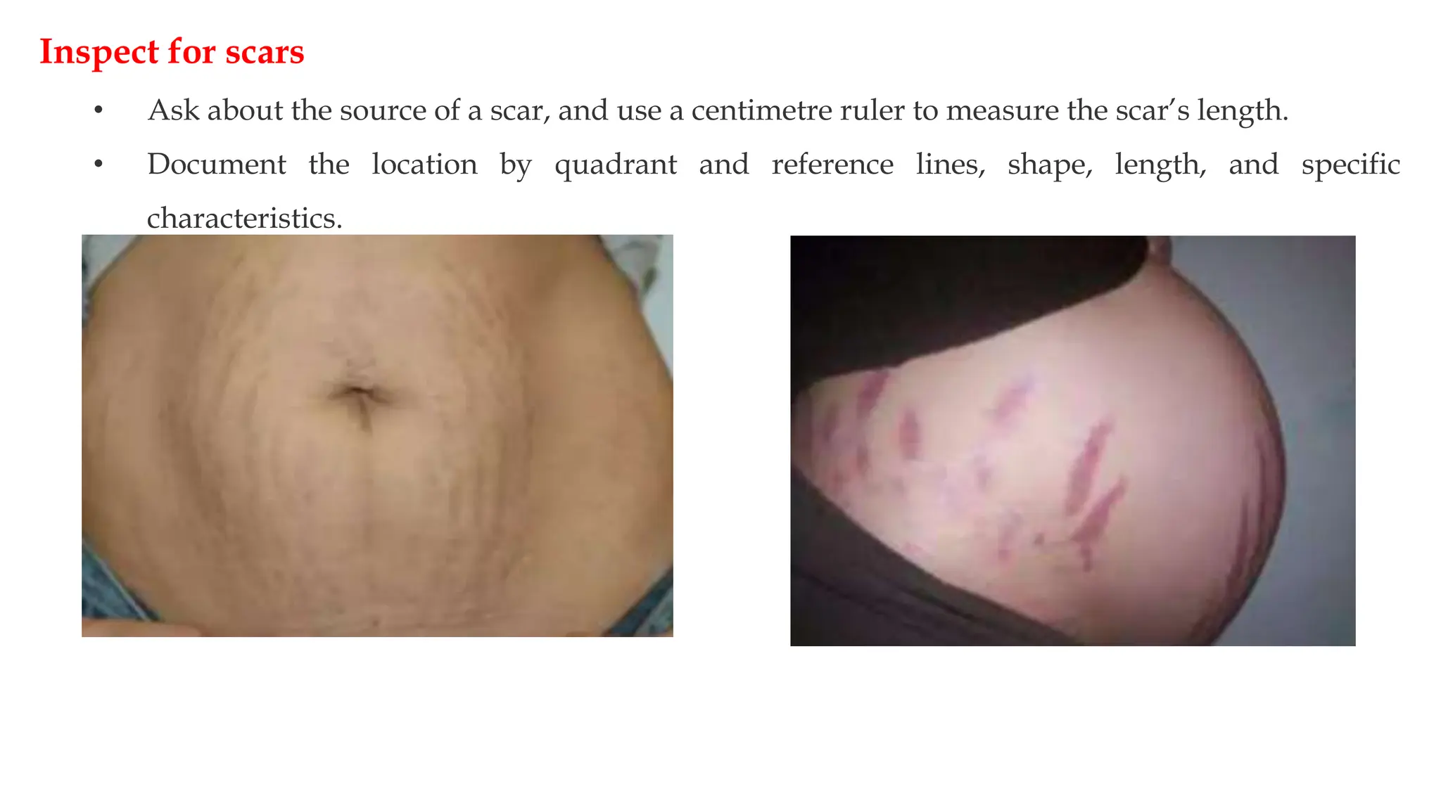 Clinical Examinations of the Abdomen with Images | PPTX