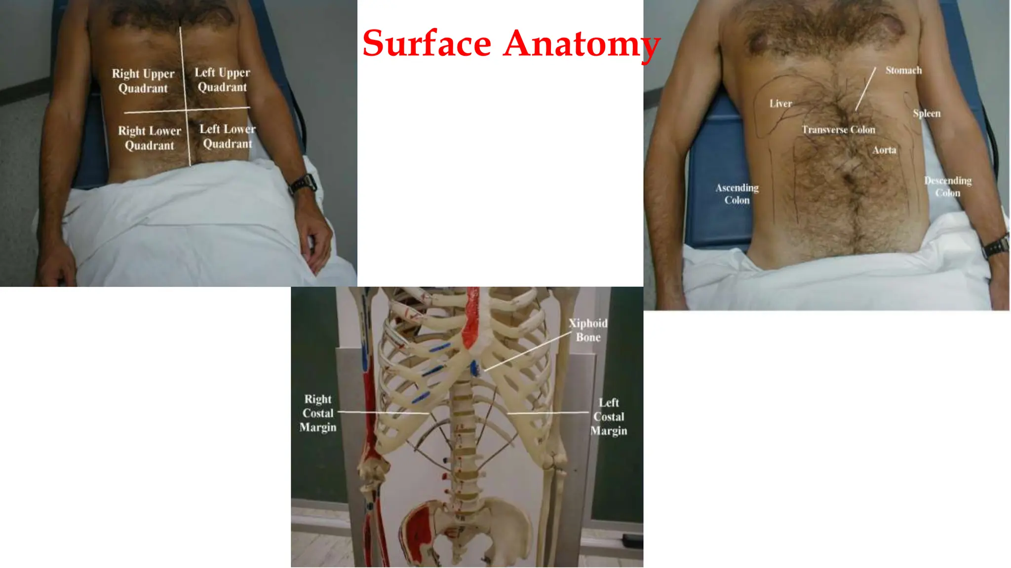 Clinical Examinations of the Abdomen with Images | PPTX