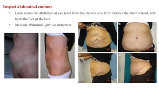 Clinical Examinations of the Abdomen with Images | PPTX